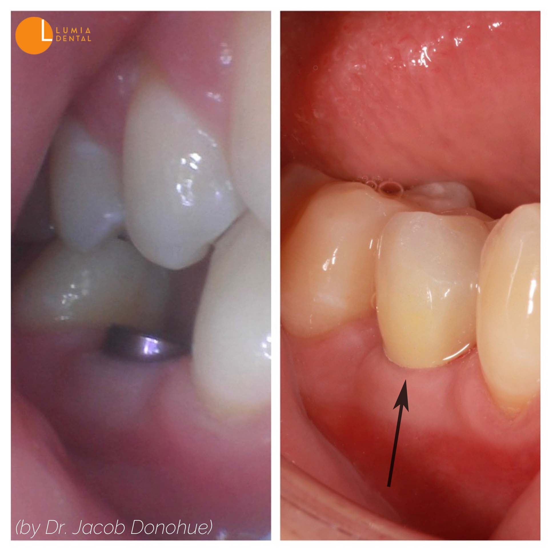 Before & after photos of our satisfied patients - Smile gallery from ...