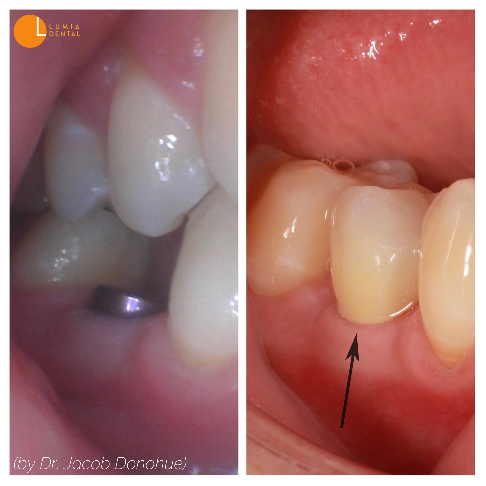 Lumia Dental in NYC | Lower Manhattan Dental Office